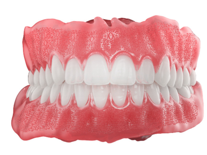 SprintRay Apex Teeth A1 500g